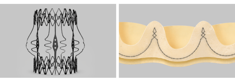 Aortic Valve Perceval - Tri DM