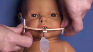 NeoBar - Sujetador Tubo Endotraqueal - Tri DM