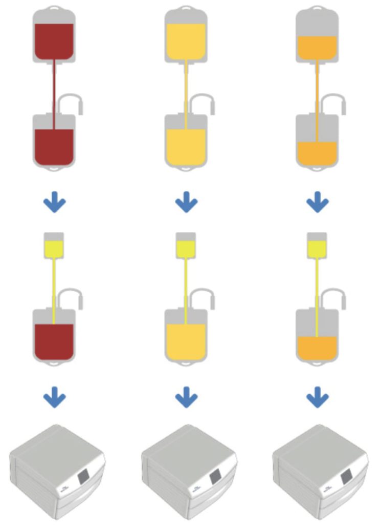 MiraSol® Pathogen Reduction Technology System - Tri DM